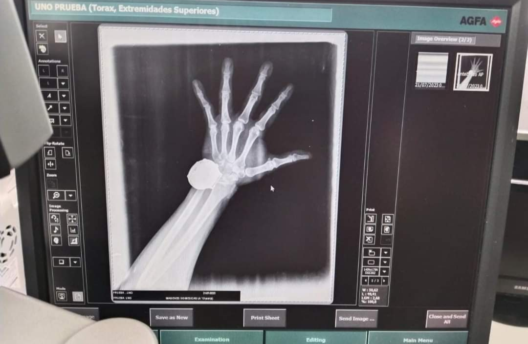 Digitalizadora RX Agfa CR.25.0 – Equipos Médicos de América